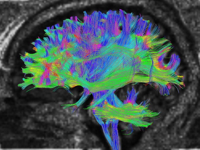 White matter model of the human brain | 3D Printing Shop | i.materialise